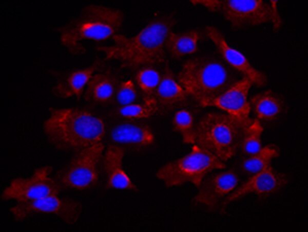 MOC1 Mouse Oral Squamous Cell Carcinoma (OSCC) Cell Line | SCC469